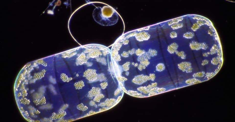 Diatom Art as a Passion - I Love IT